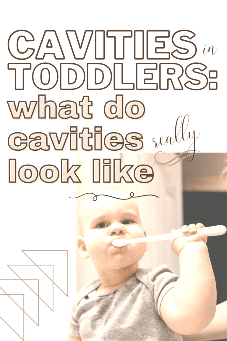 Cavities in Toddlers: What Does a Cavity Look Like?